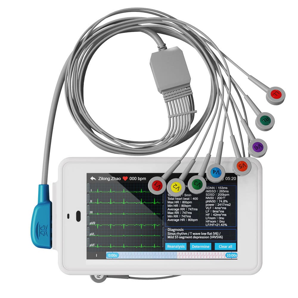 Holter ECG 12 canales - PC-ECG 500 - Viatom by Lepu