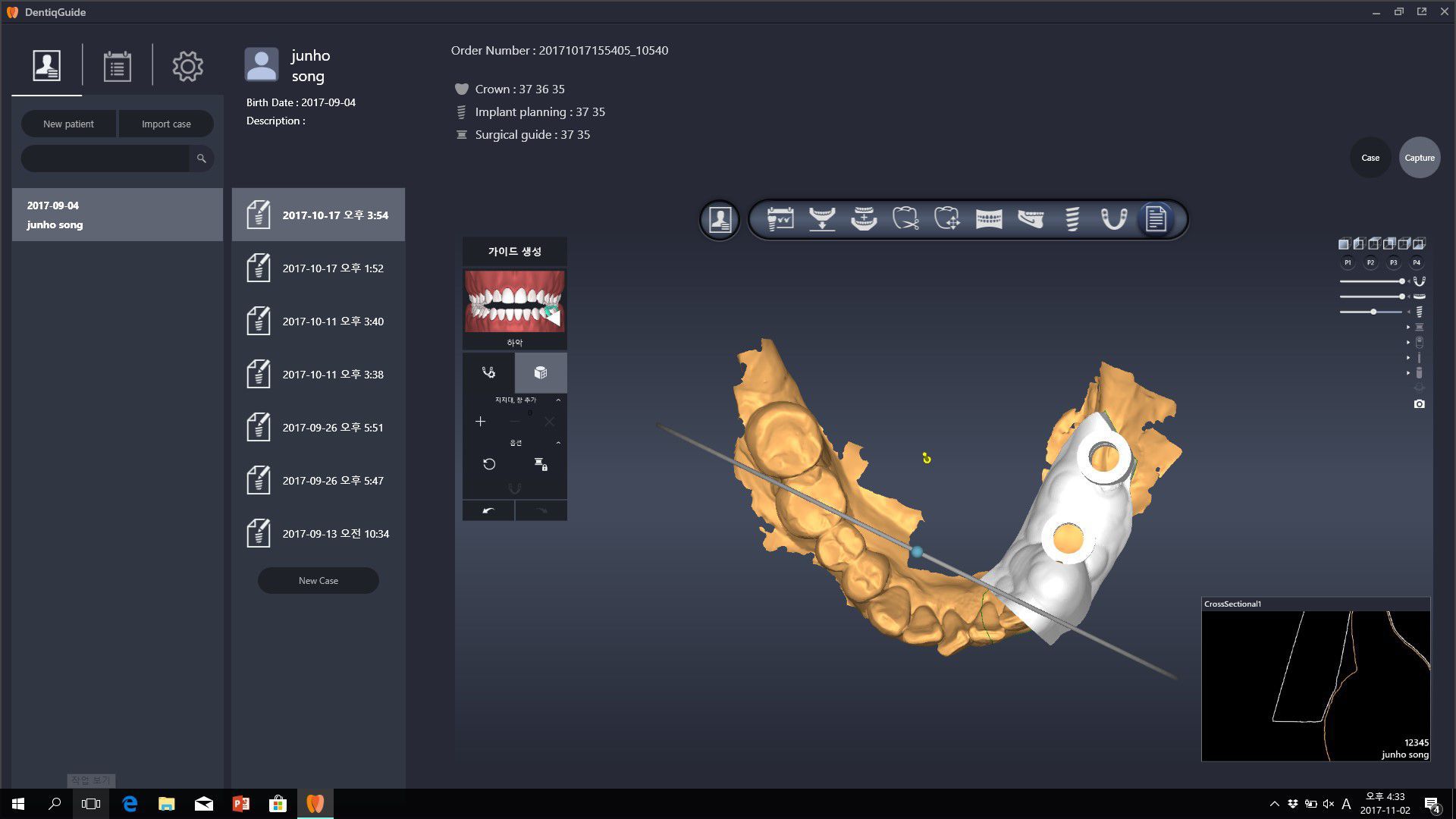 Software de planificación - Dentiq Guide - 3D Industrial Imaging, Co ...