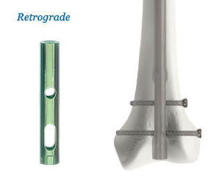 Clavo intramedular fémur - AOS - Advanced Orthopaedic Solutions
