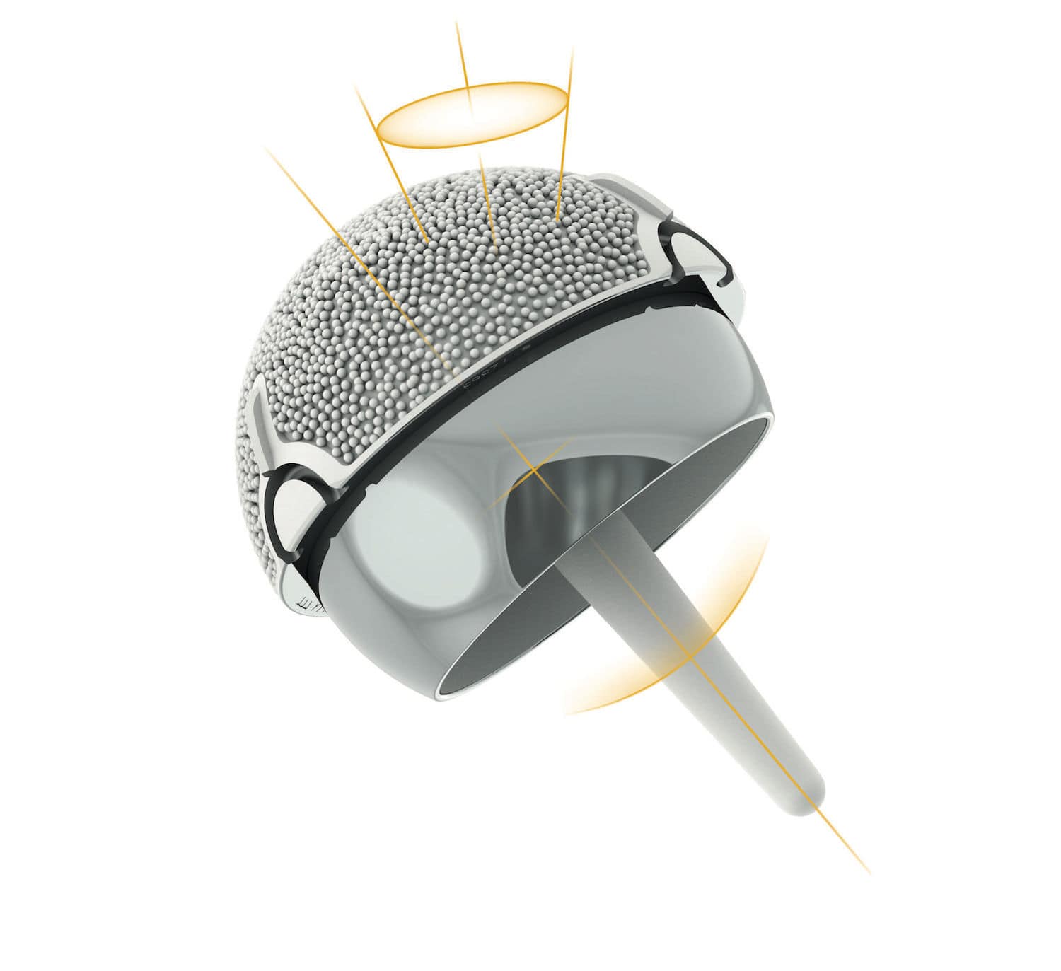 Prótesis de cabeza femoral - ADEPT® - MatOrtho