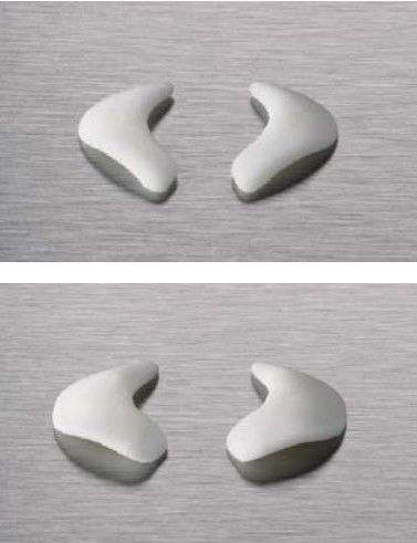 Implante nasal - OP9519 - Matrix Surgical USA - anatómico / de polietileno