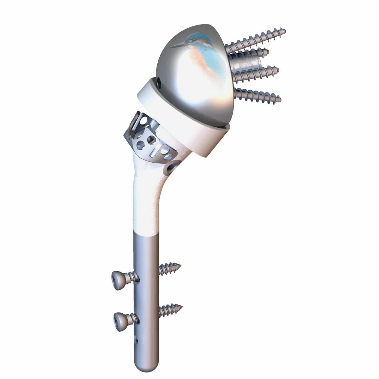 Tallo humeral inverso - HUMELOCK II® - FX Solutions - no cementado