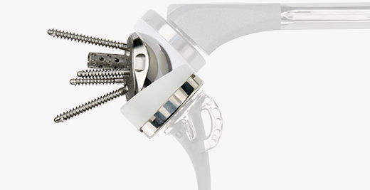 Prótesis de hombro inversa - Equinoxe Reverse - Exactech - Vídeos