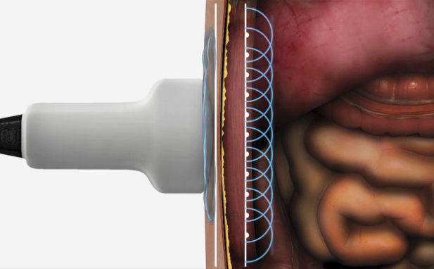 Módulo de simulación para ecografía - Physics 1 - SIMTICS - de anatomía ...