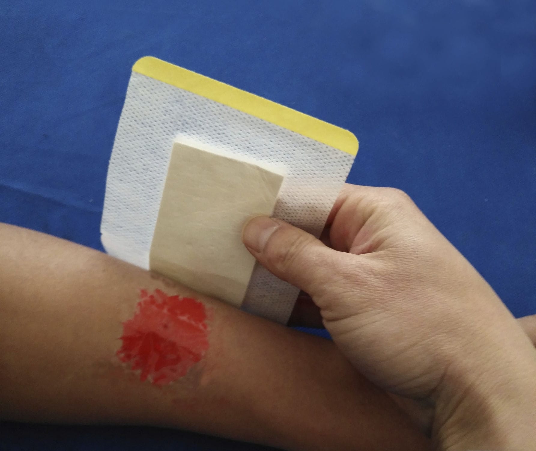 Rollo de gasa / hemostático / antibacteriano - 5x5 cm - Hongkong Medi