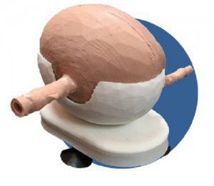 Modelo anatómico de vejiga - 3D Lifeprints UK Ltd - para endoscopia