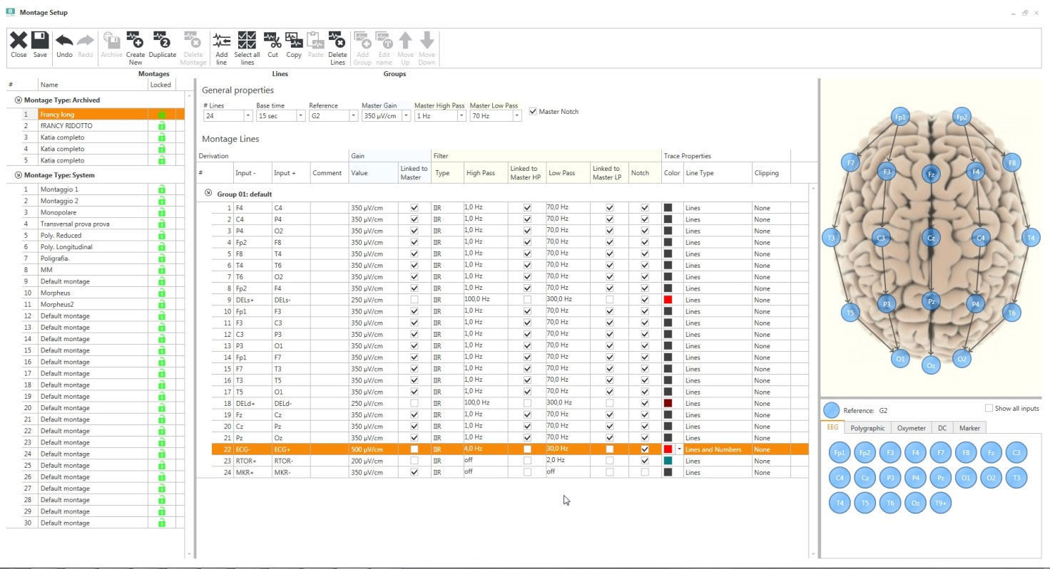 Software de hospital - Micromed Italy - para EEG / para historias ...