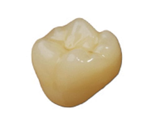 Corona dental de PMMA - CAD Temp - Derby Dental - de los dientes ...