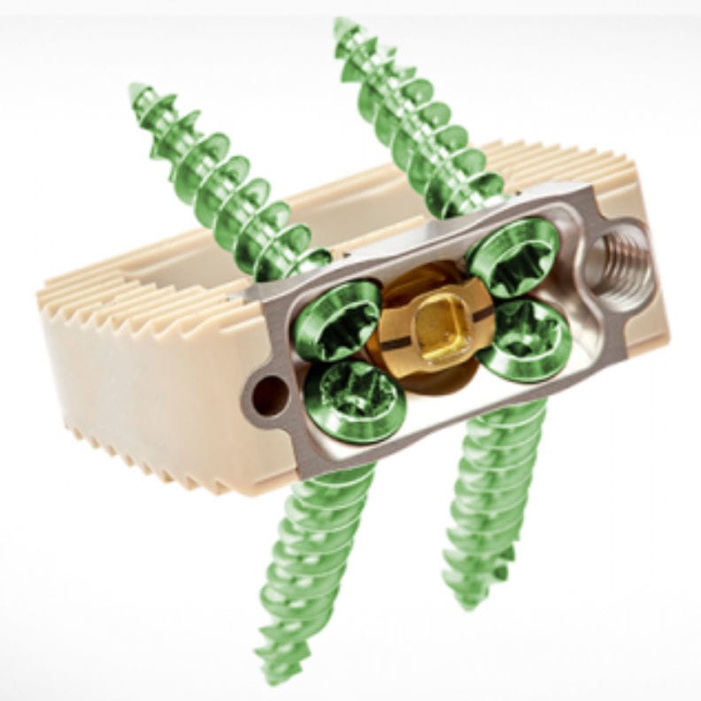 Caja intersomática lumbar - Spineology - vía anterior / de PEEK