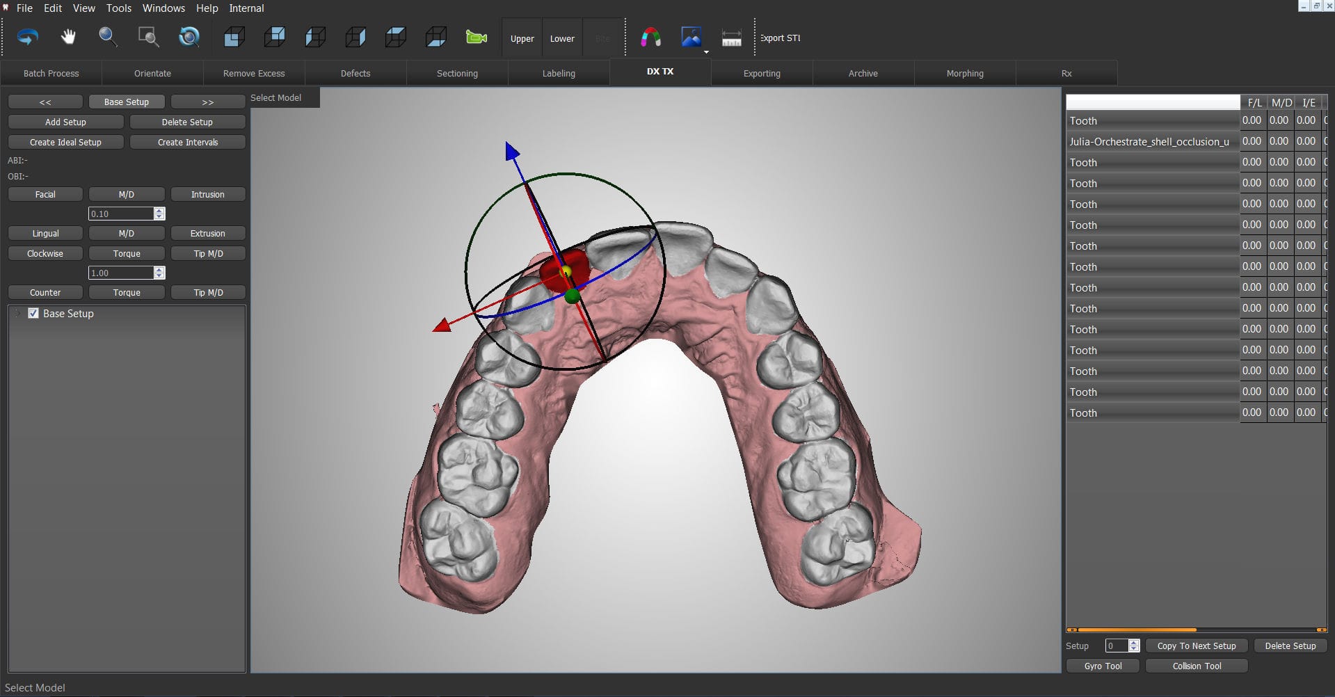 Software ortodóntico - O3D - Orchestrate Orthodontic Technologies - de ...