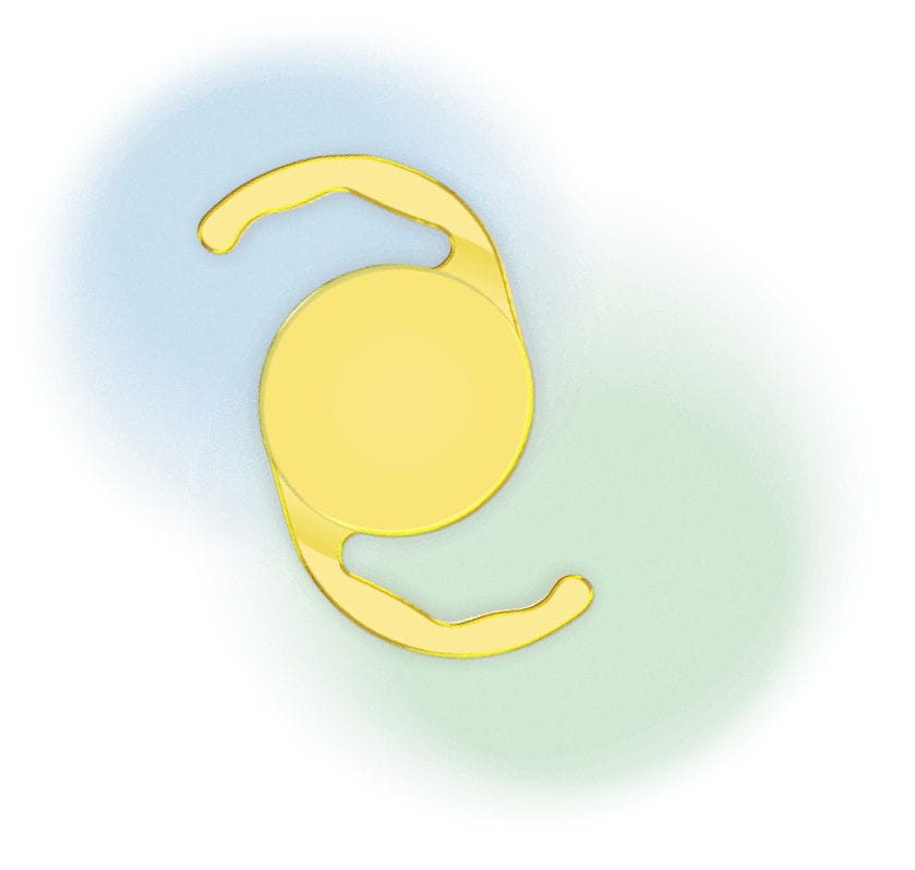 Lente intraocular monofocal - Ev gold - Aurolab