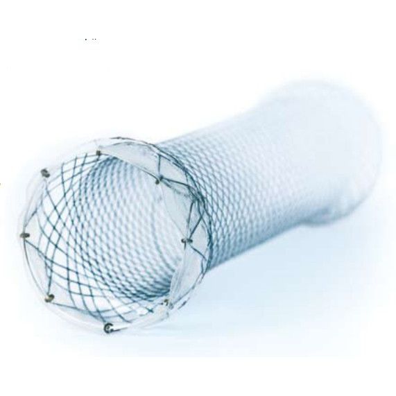 Stent esofágico - ST31 - Luda Medica - de nitinol / autoexpandible