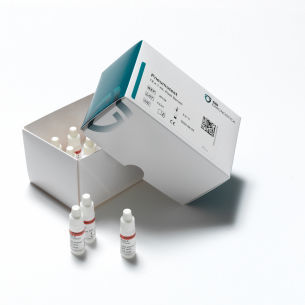 Kit de reactivos de suero - 36158 - SSI Diagnostica - antisuero ...