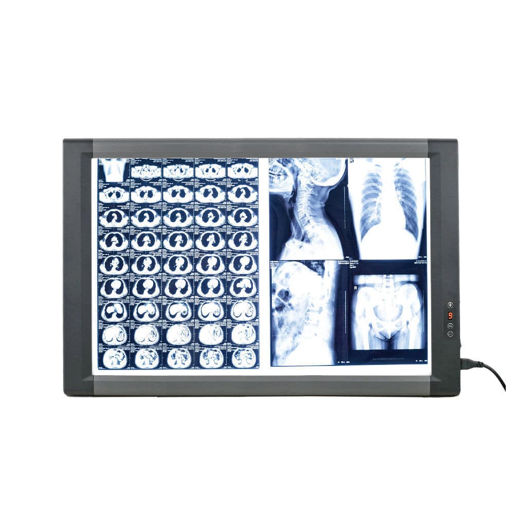 Negatoscopio digital - MG02 - Nanchang Micare Medical Equipment - 2 ...
