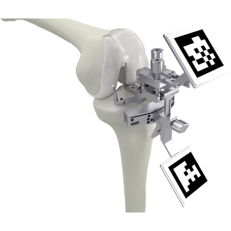 Sistema de análisis de movimiento del LCA - PIXEE KNEE + - Gruppo ...