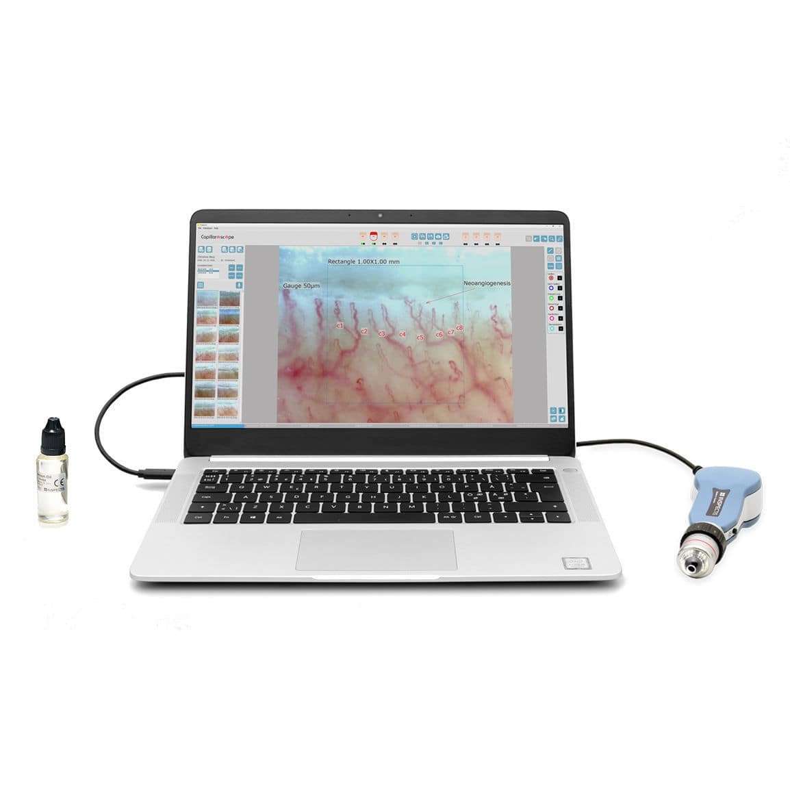 Capilaroscopio de vídeo - DM-120 CapiScope series - Inspectis - para PC