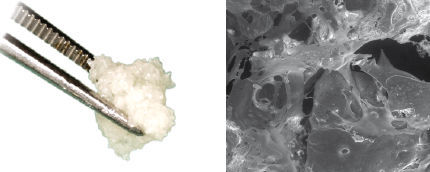 Sustituto óseo xenotransplante - Smartbone® - IBI - Industrie ...