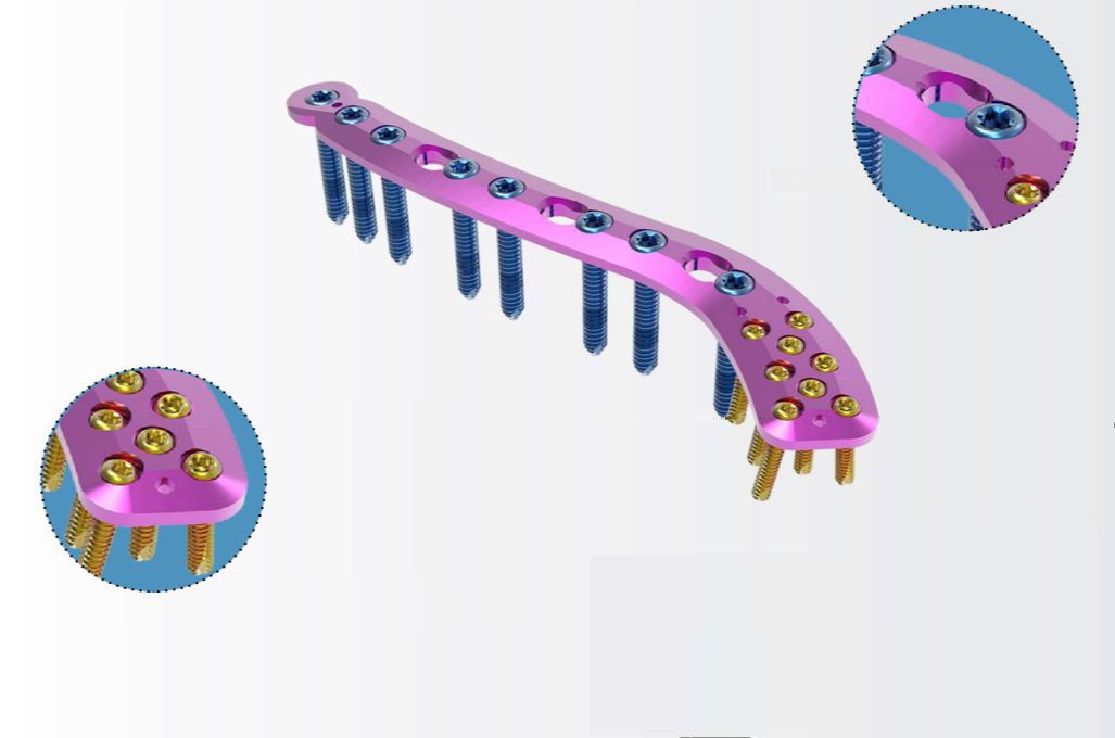 Placa de compresión para clavícula - TRUE LOCK Superior Distal Clavicle ...