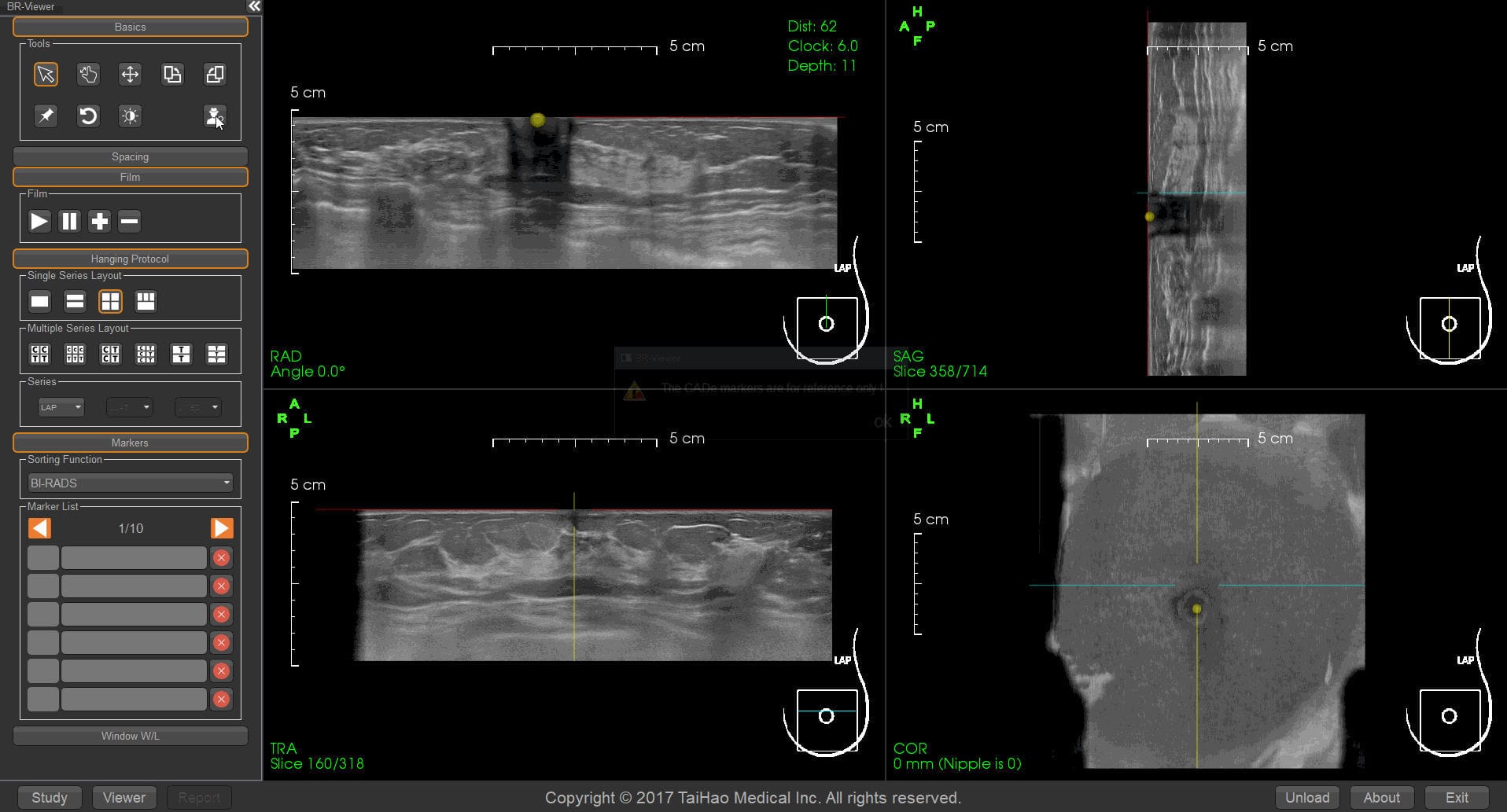 Software para informes - BR-Viewer™ - TaiHao Medical - visualizador ...