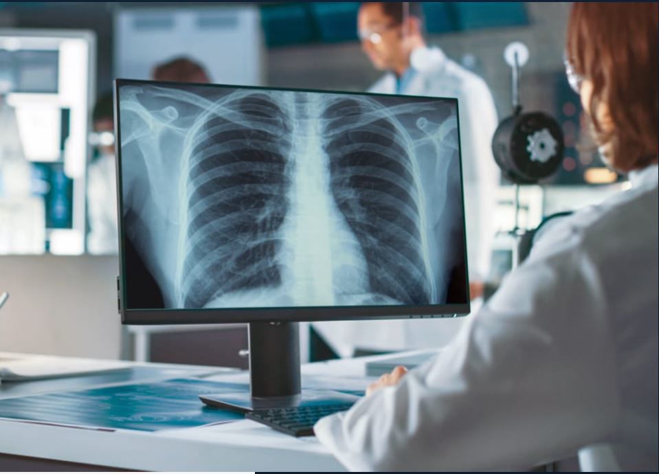 Radiografia De Ocronose Ocronosis: Reporte De Caso Y Revisión De La