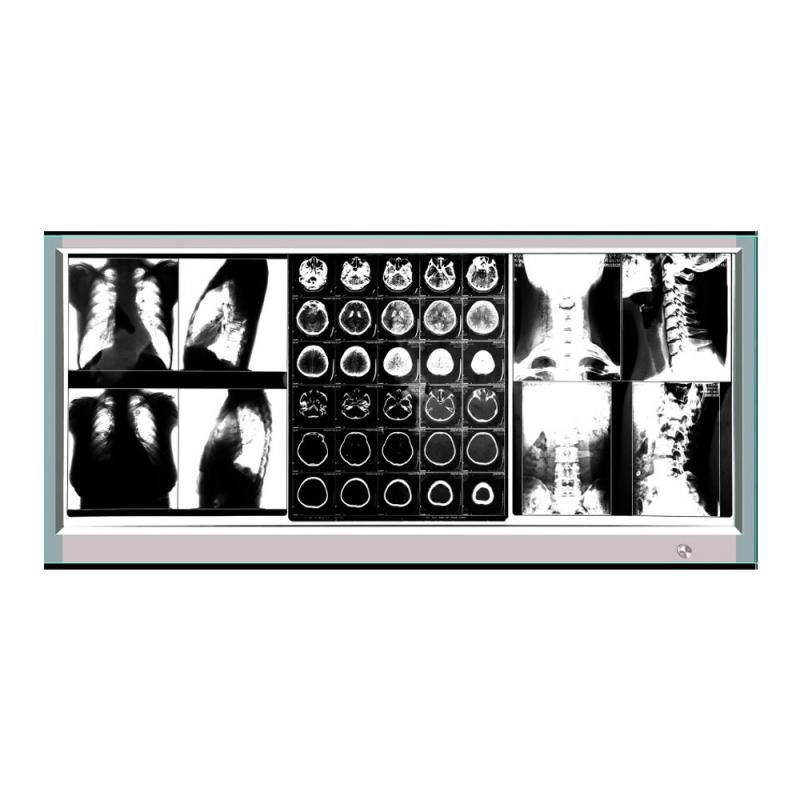 Negatoscopio 3 pantallas - GP1003A - Bellamoon Medical - LED