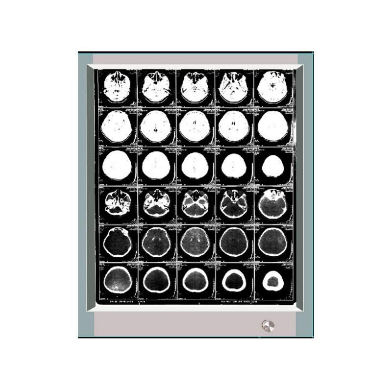 Negatoscopio 1 pantalla - GP1001A - Bellamoon Medical - LED
