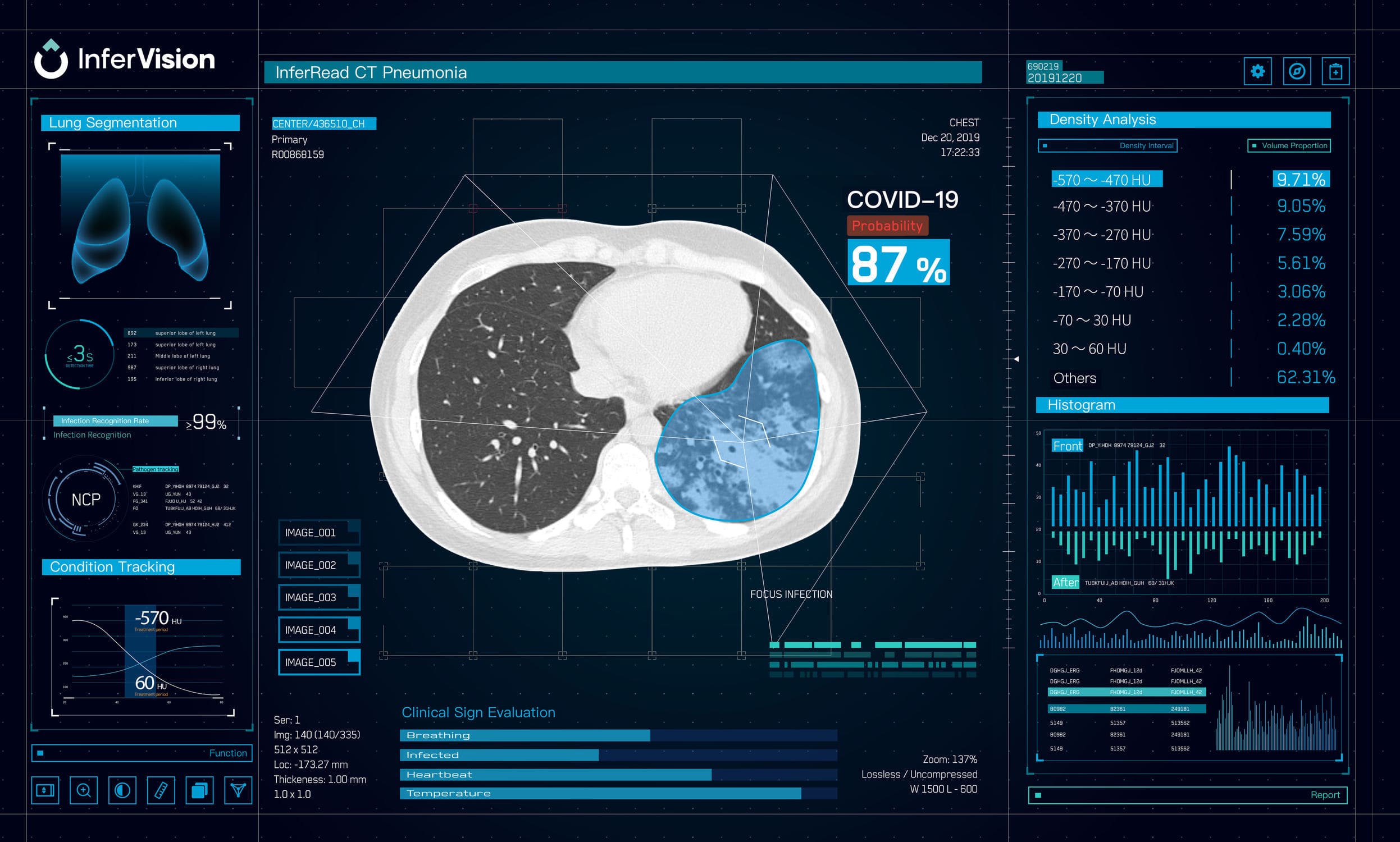 Software médico - Beijing Infervision Technology Co. Ltd. - de análisis ...