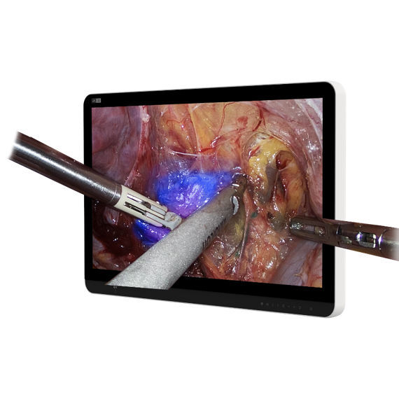 Monitor 4K - MIK-M3208SC3ALS - Hikimaging - para imágenes médicas / quirúrgico / 31.5"