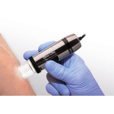 Dermatoscopio de vídeo - Dino-lite - Comitas e- Health - LED blanca