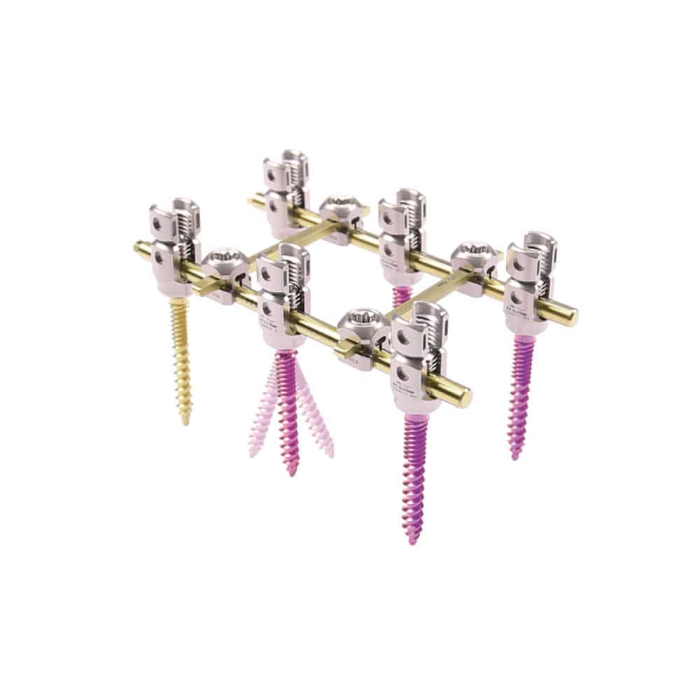 Sistema de osteosíntesis toracolumbar - JZPA 5.5 - Kangli Medical - vía ...