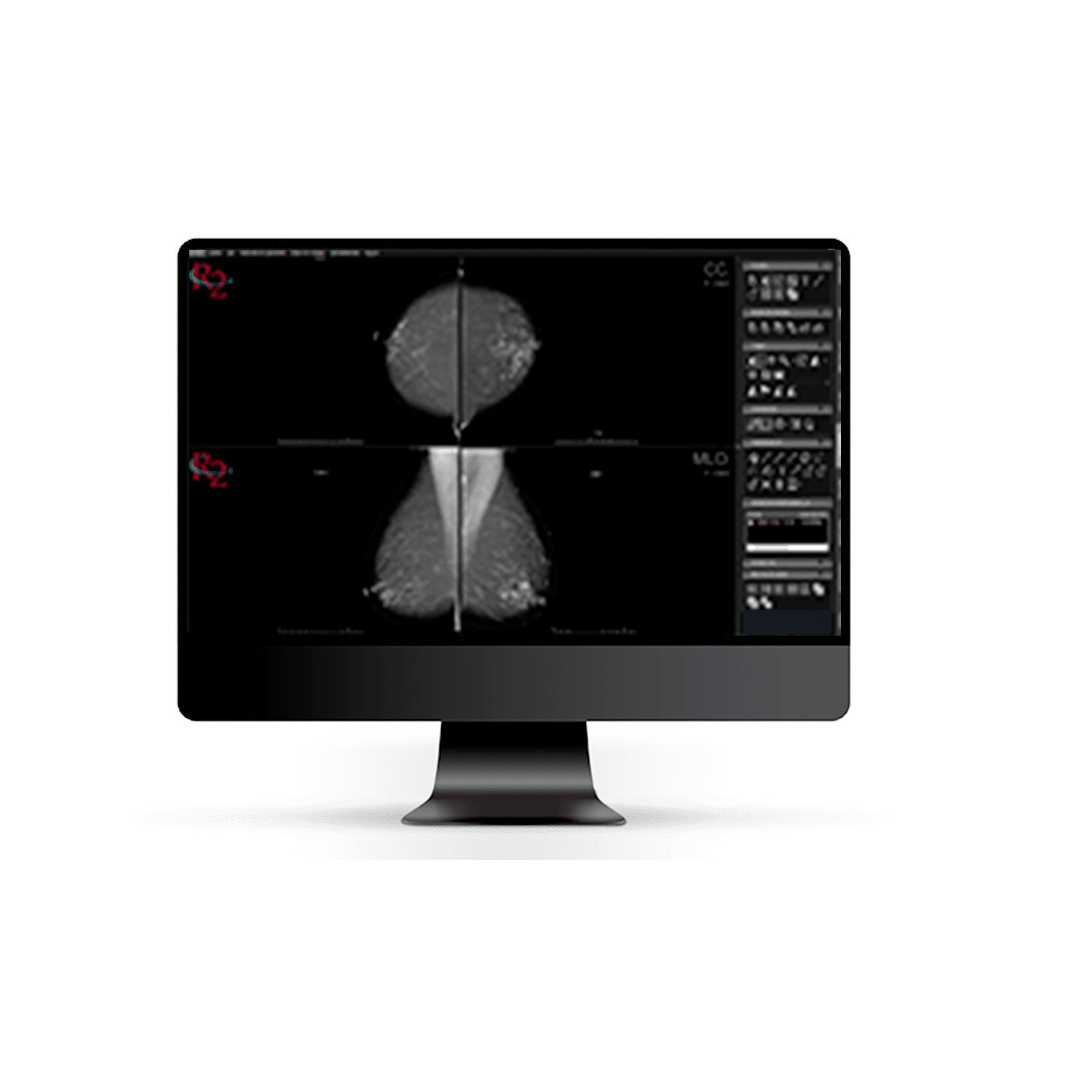 Visor de imágenes DICOM - FireVIEW MAMMO - Firethunder