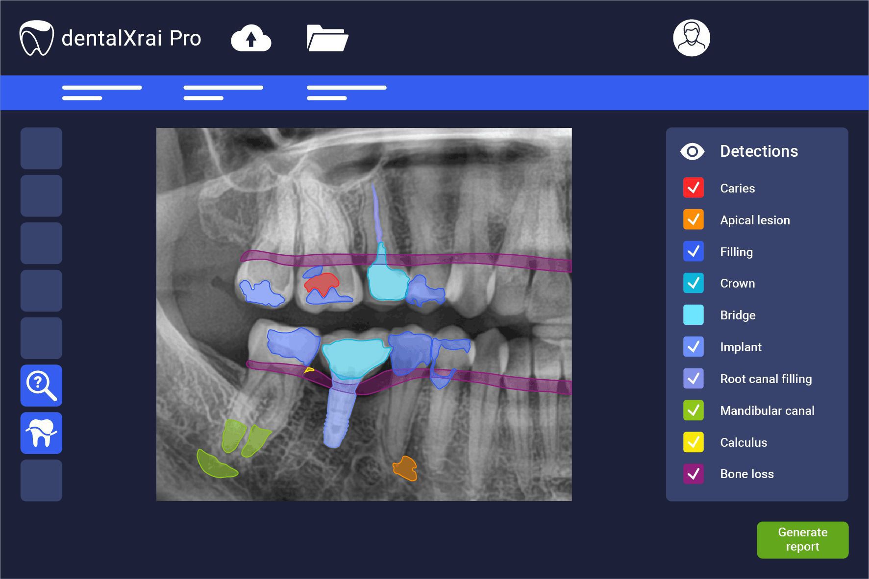 Software de análisis - dentalXrai Pro 3.0 - dentalXrai GmbH - de ...