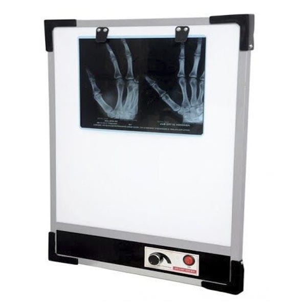 Negatoscopio digital - MV-FV2 - Mediveron - 1 pantalla / LED / con ...