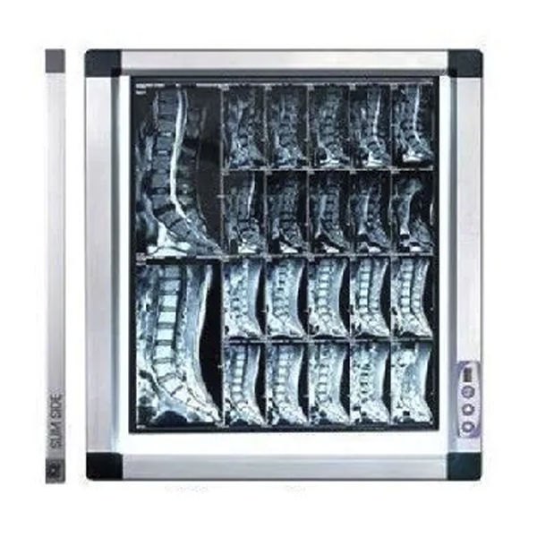 Negatoscopio digital - MV-FV4 - Mediveron - 1 pantalla / LED / con ...