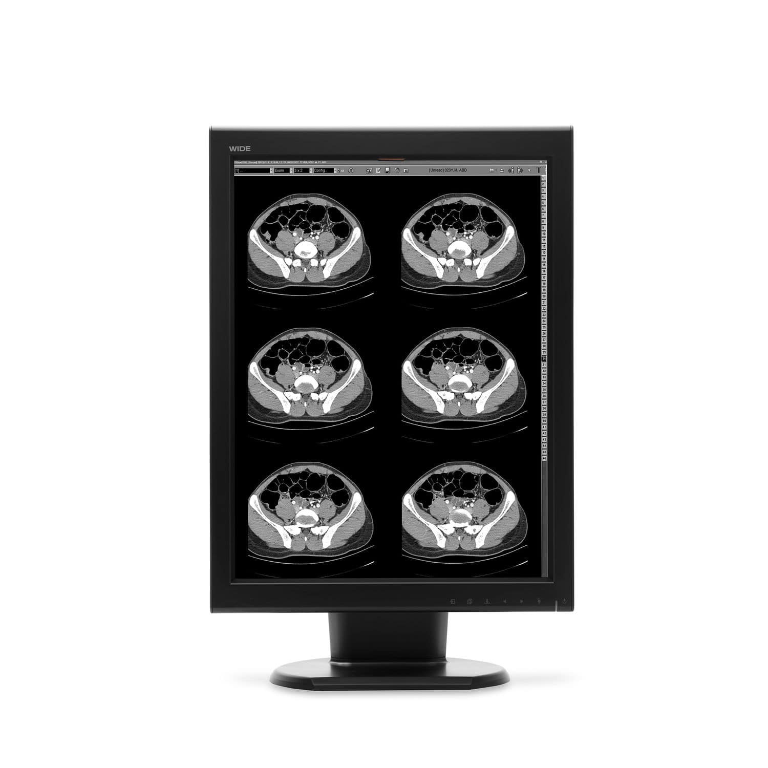 Monitor de diagnóstico - MX20N - Wide USA Corporation - para imágenes ...
