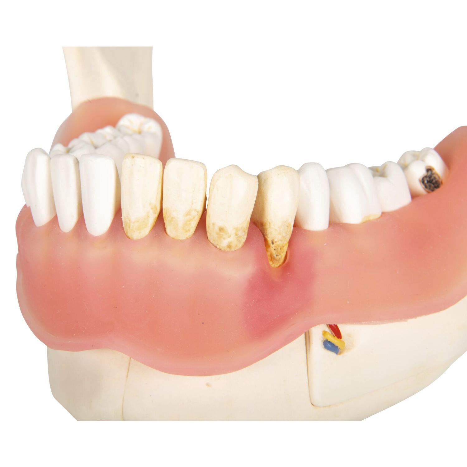 Modelo anatómico de mandíbula - D26 - 3B Scientific - de dientes / de ...