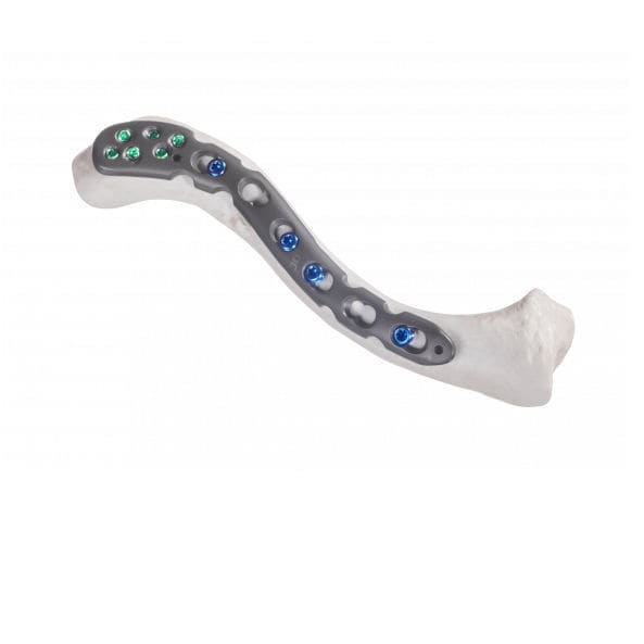 Placa de compresión para clavícula - 10-54813 - AF Medical ...