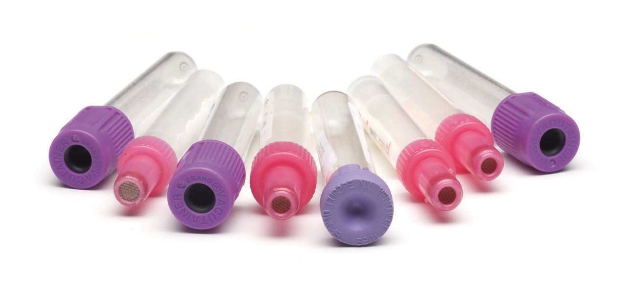 Analizador de ESR automático - MINI-CUBE - Diesse Diagnostica Senese ...