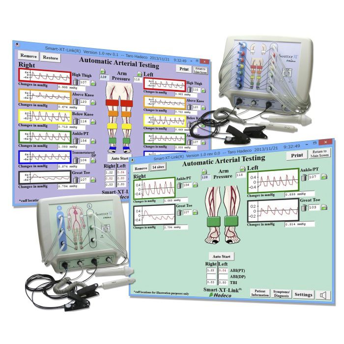 Doppler de mesa - Smartdop XT - Hadeco - ABI