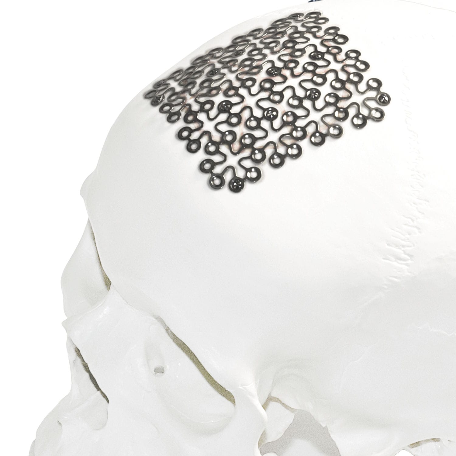 Implante craneal - Jeil Medical Corporation