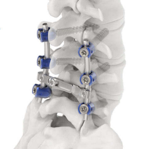 Sistema de osteosíntesis lumbar - Jeil Medical Corporation - vía ...