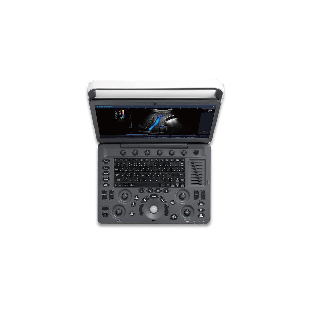 Ecógrafo portátil - E2 - SonoScape - para ecografía polivalente / blanco y negro / doppler-color