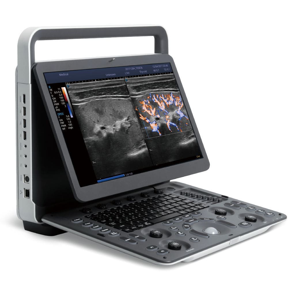 Ecógrafo portátil - E2 - SonoScape - para ecografía polivalente / blanco y negro / doppler-color