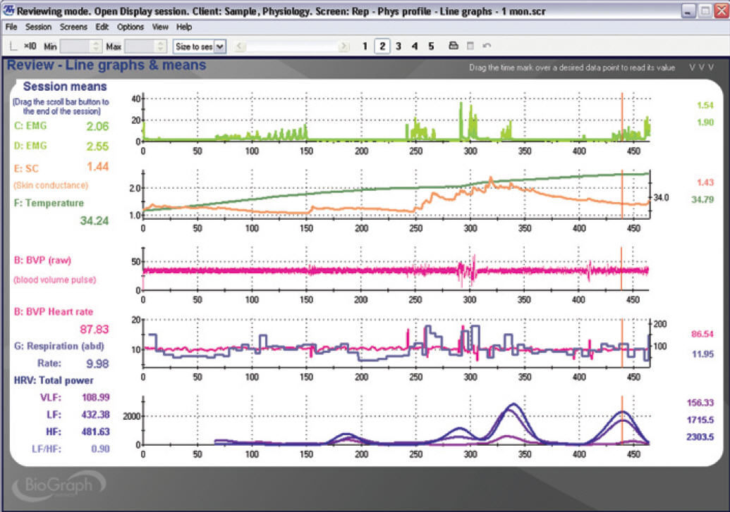 Software de captura - BioGraph Infiniti T7900 / T7900UP - Thought ...