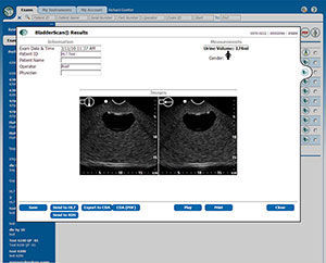 Software de gestión de informes de pacientes - ScanPoint® - Verathon ...