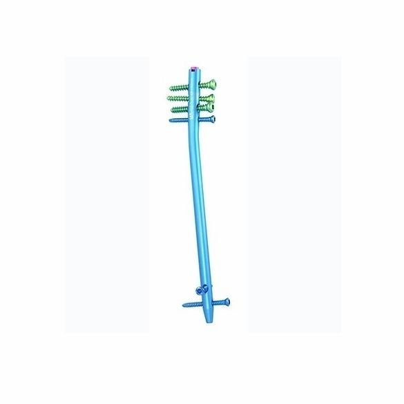 Clavo intramedular para húmero - Double Medical Technology - fijación ...