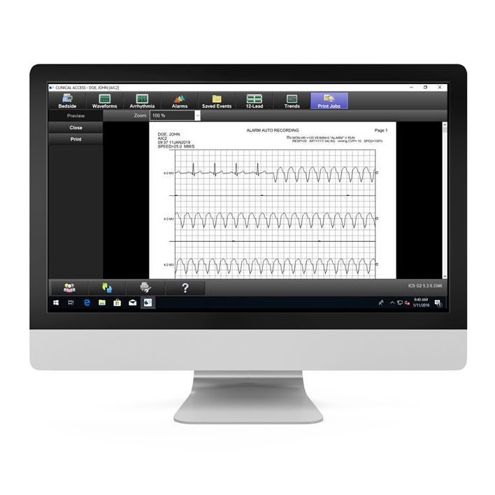 Módulo de software de gestión de impresión - Spacelabs Healthcare ...