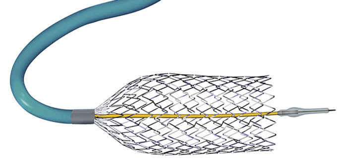 Stent arteria carótida - PRECISE® PRO RX® - Cordis - de nitinol