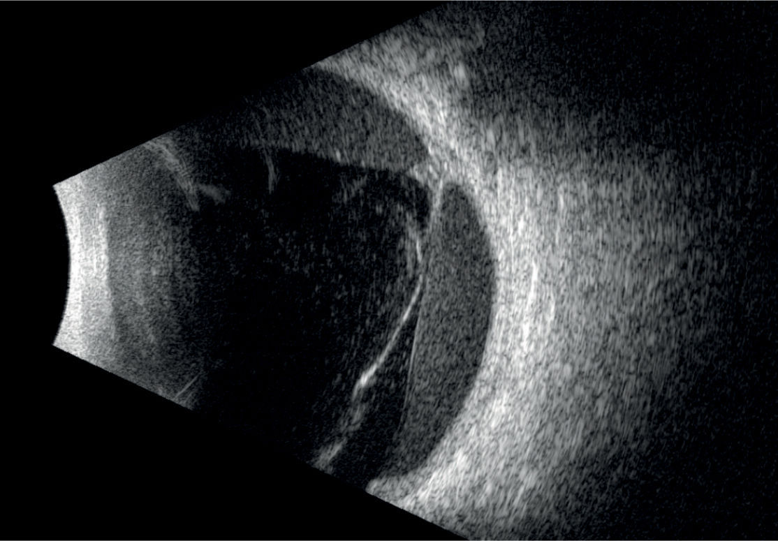 Ecógrafo en plataforma, de mesa / para exploración oftálmica / blanco y ...
