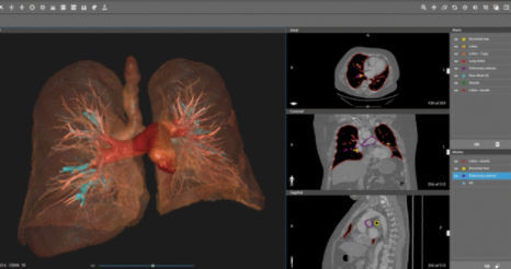 Software de visualización - D2P® - 3D Systems - de diagnóstico / de ...